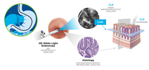 Cellvizio® Overview - Mauna Kea Technologies