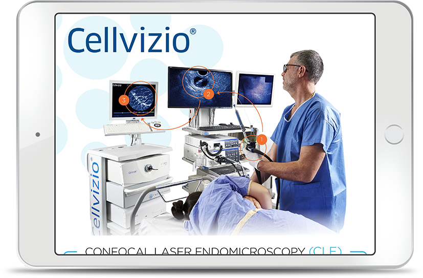 Cellvizio® Overview - Mauna Kea Technologies